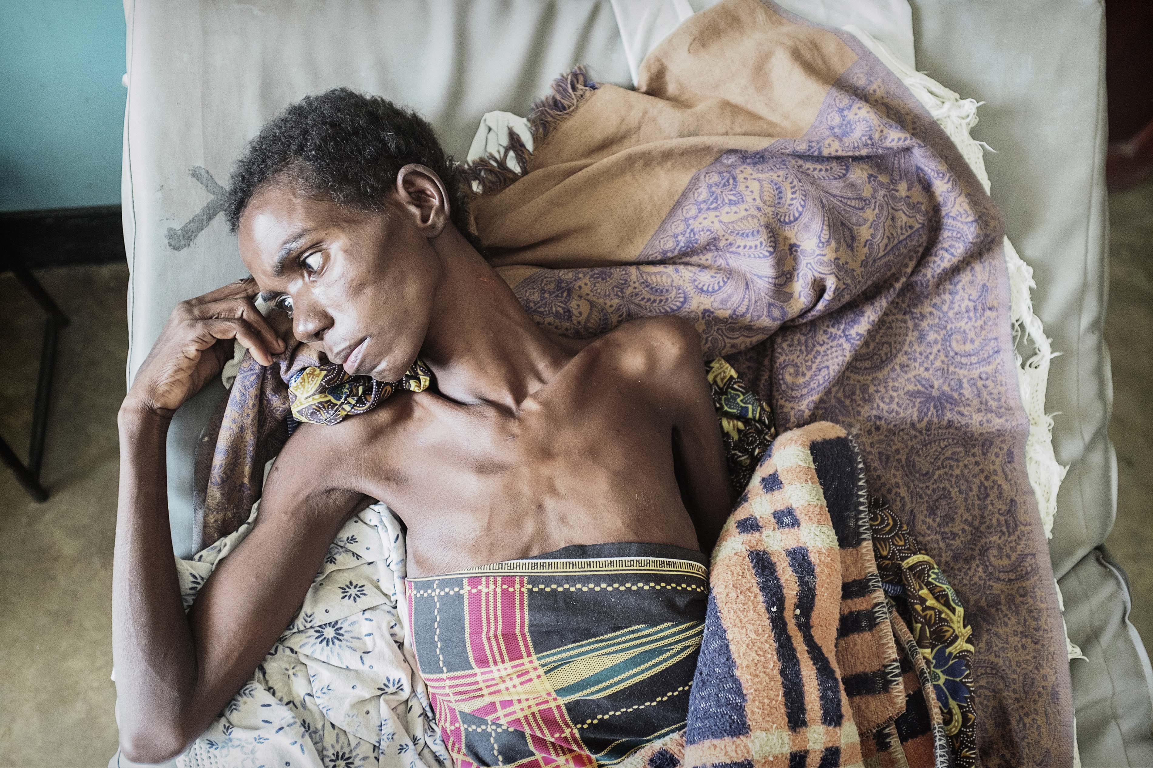 MSF Sounds Alarm Over High Numbers Of People Dying From AIDS In Sub